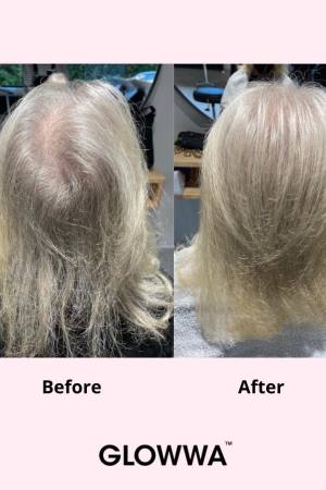 GLOWWA Hair Growth Supplements, Top Hair Salon In Hungerford